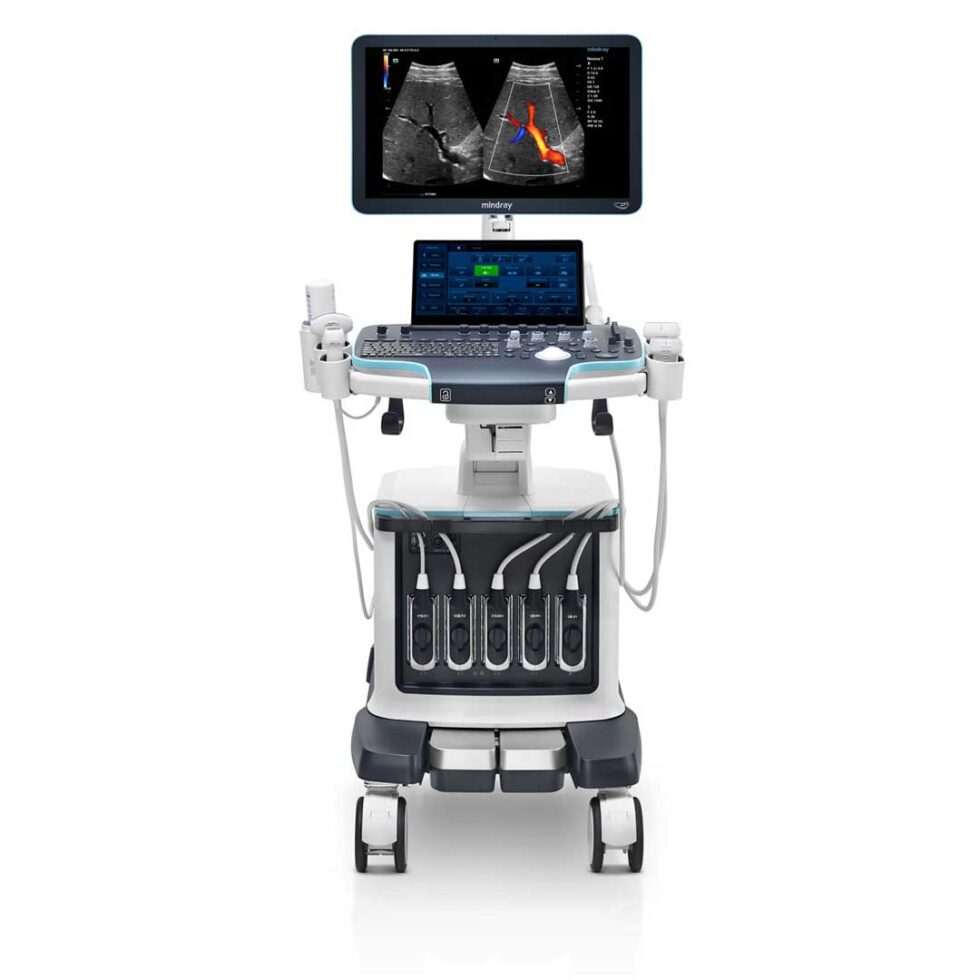 Understanding How Ultrasound Machines Work | Bomimed